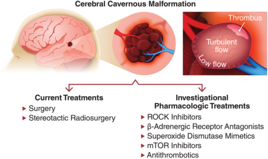 Cavernous Malformations (Cavernoma) - AANS/CNS Cerebrovascular Section